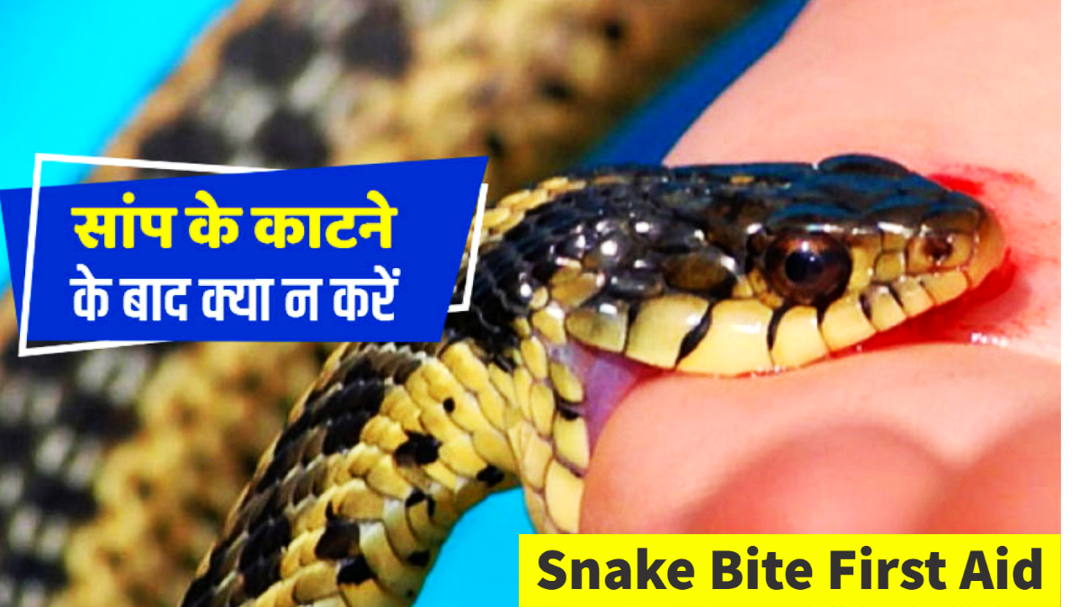 Snake Bite Symptoms, First Aid : सांप के काटने के बाद क्या लक्षण होते हैं